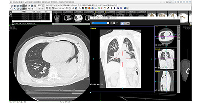 SoliPACS Server Ver.12 リリース | 株式会社イービーエム・ヘルスケア