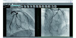 SoliPACS Zero | 株式会社イービーエム・ヘルスケア